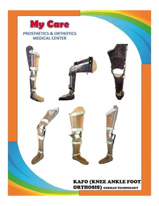 Artificial limbs Orthotic insoles polio callipers orthopedic shoe | PDF