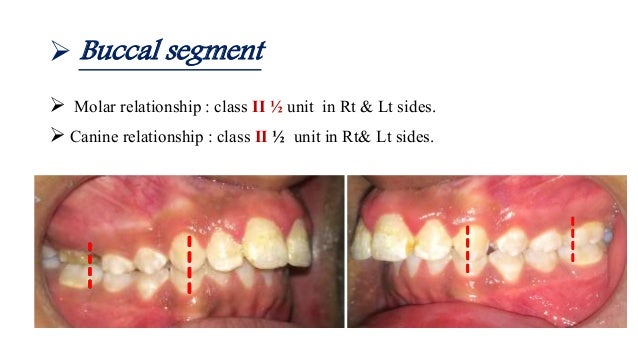 Dr-Osama case presentation