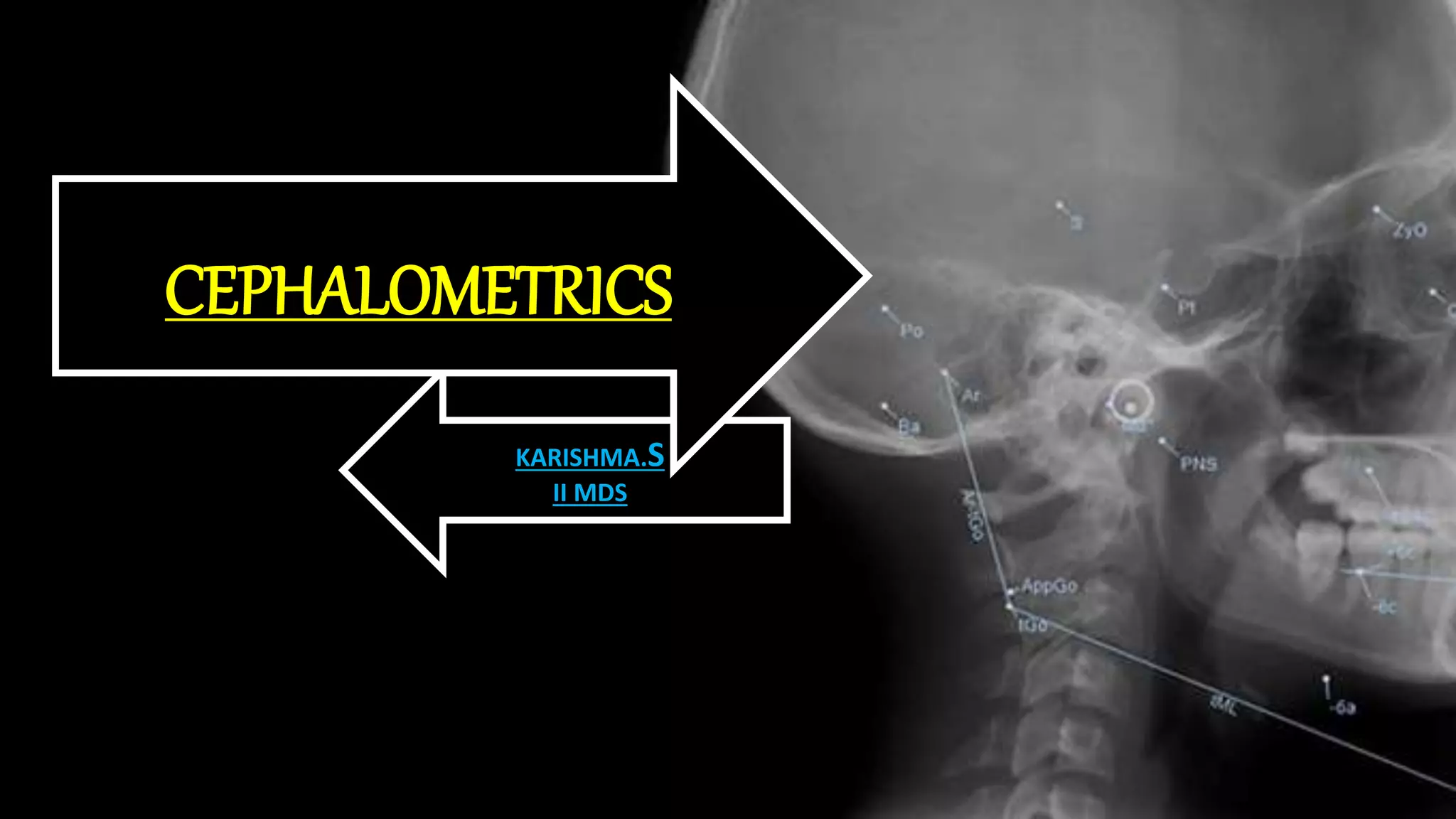 CEPHELOMETRICS IN PEDIATRIC DENTISTRY | PPTX