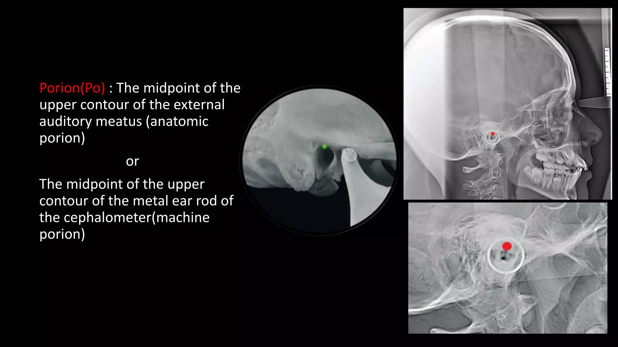 CEPHELOMETRICS IN PEDIATRIC DENTISTRY | PPTX