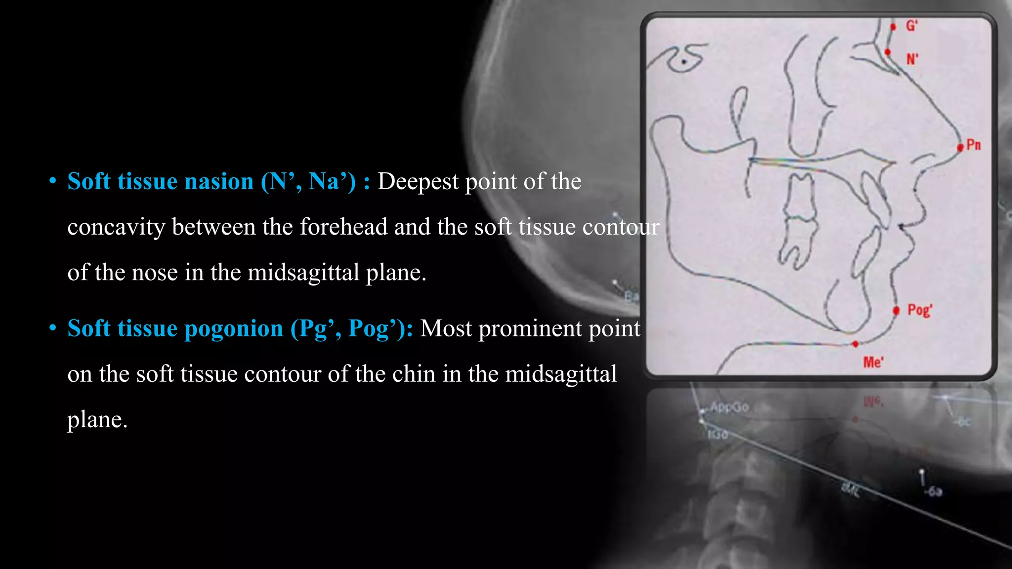 CEPHELOMETRICS IN PEDIATRIC DENTISTRY | PPTX