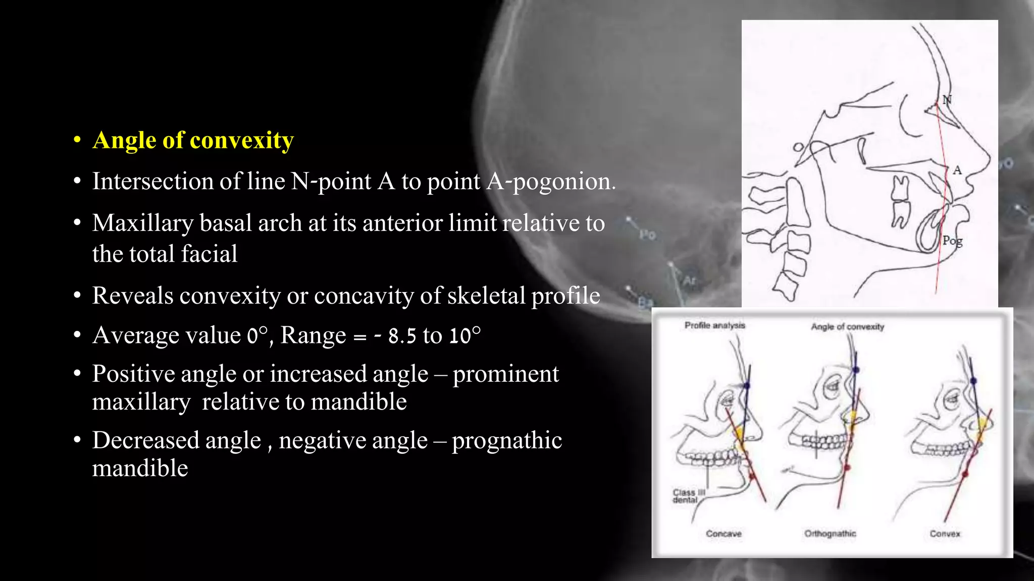 CEPHELOMETRICS IN PEDIATRIC DENTISTRY | PPTX