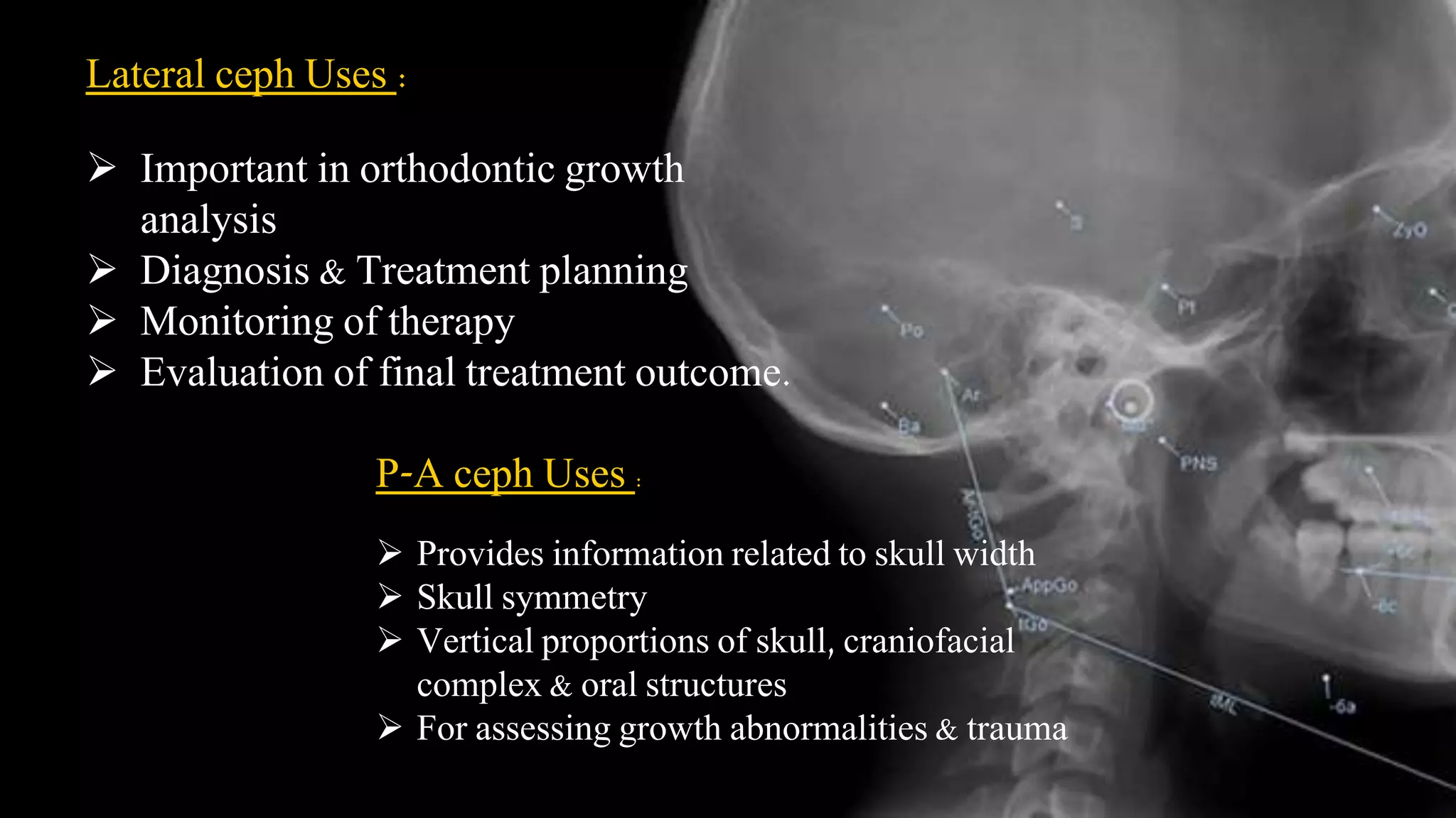 CEPHELOMETRICS IN PEDIATRIC DENTISTRY | PPTX