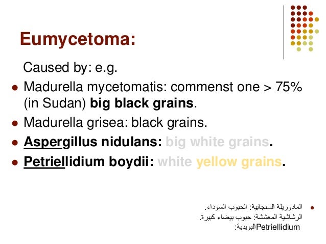 Mycetoma