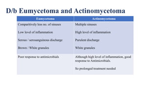 Actinomycetoma