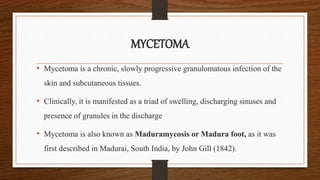 Mycetoma | PPTX