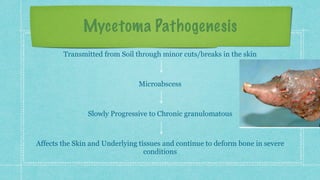 Mycetoma.pdf