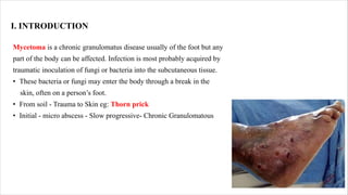 MYCETOMA infectious diseases ppt-2.pdf