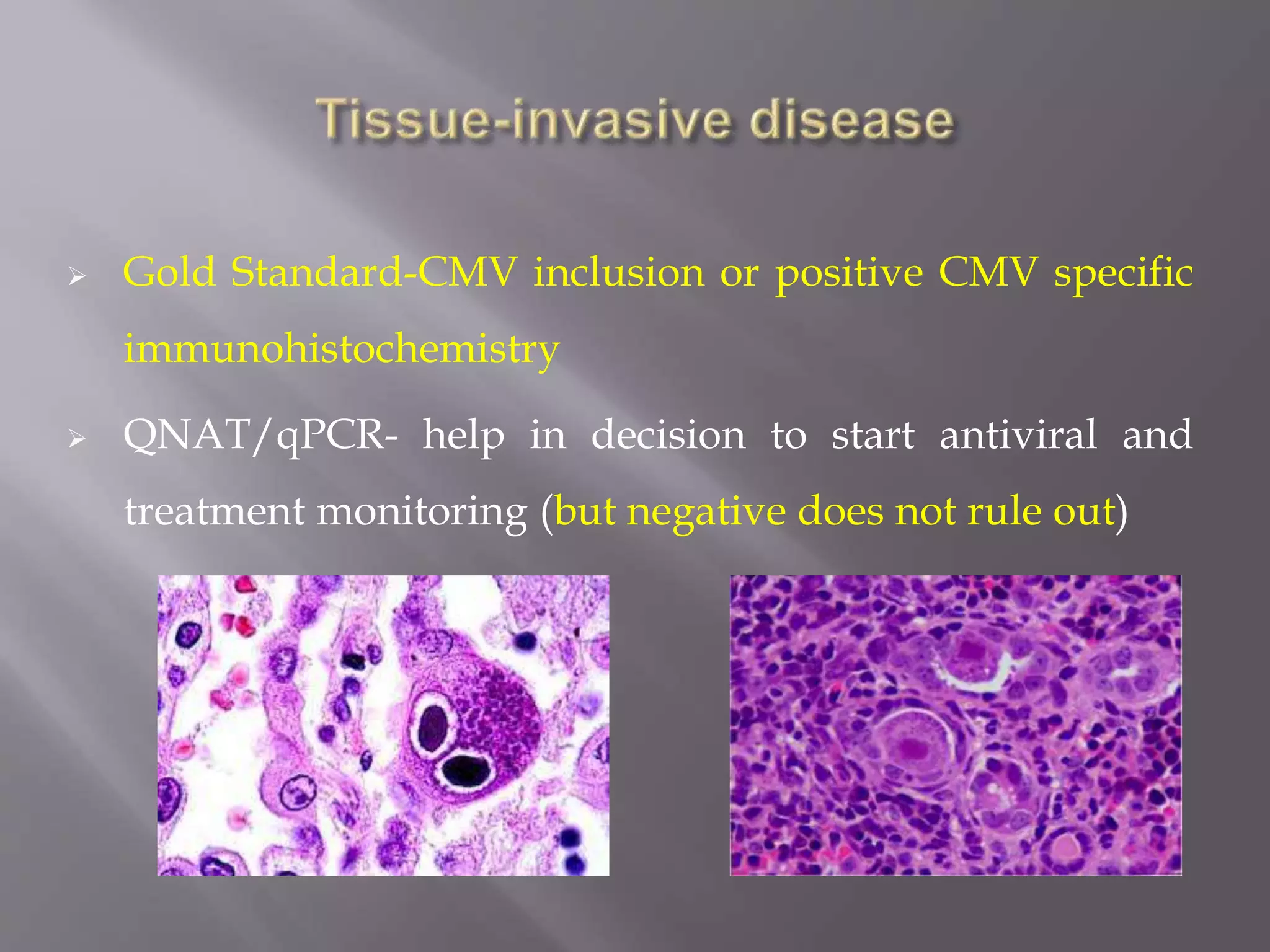 CMV in Renal Transplant | PPTX
