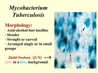 Mycobacteria - Prac. Microbiology | PPT