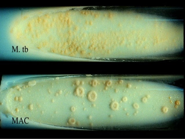 Mycobacteria - Prac. Microbiology