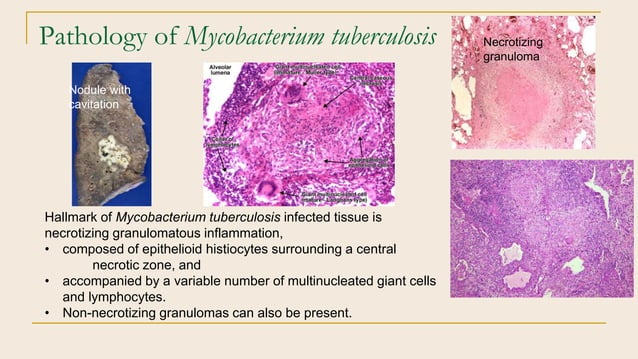 Mycobacteriology 2020 | PPT