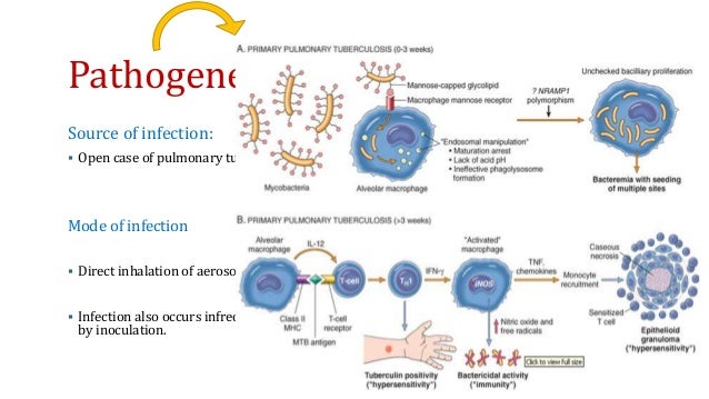 Mycobacterium