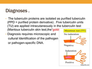 Mycobacterium | PPTX