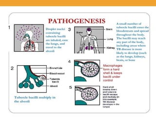 Mycobacterium | PPT
