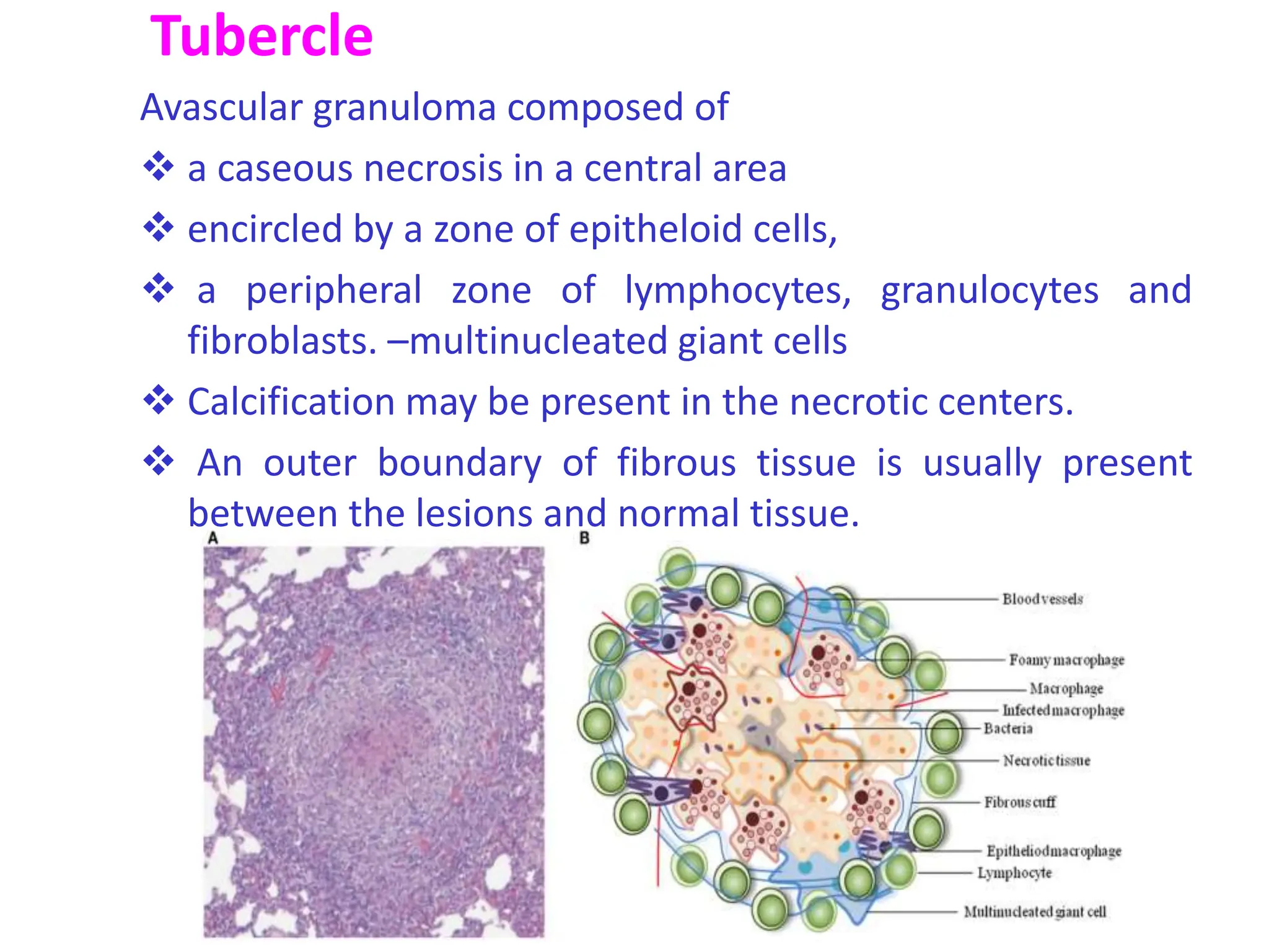 Mycobacterium.ppt bacterial diseases. Tb | PPT