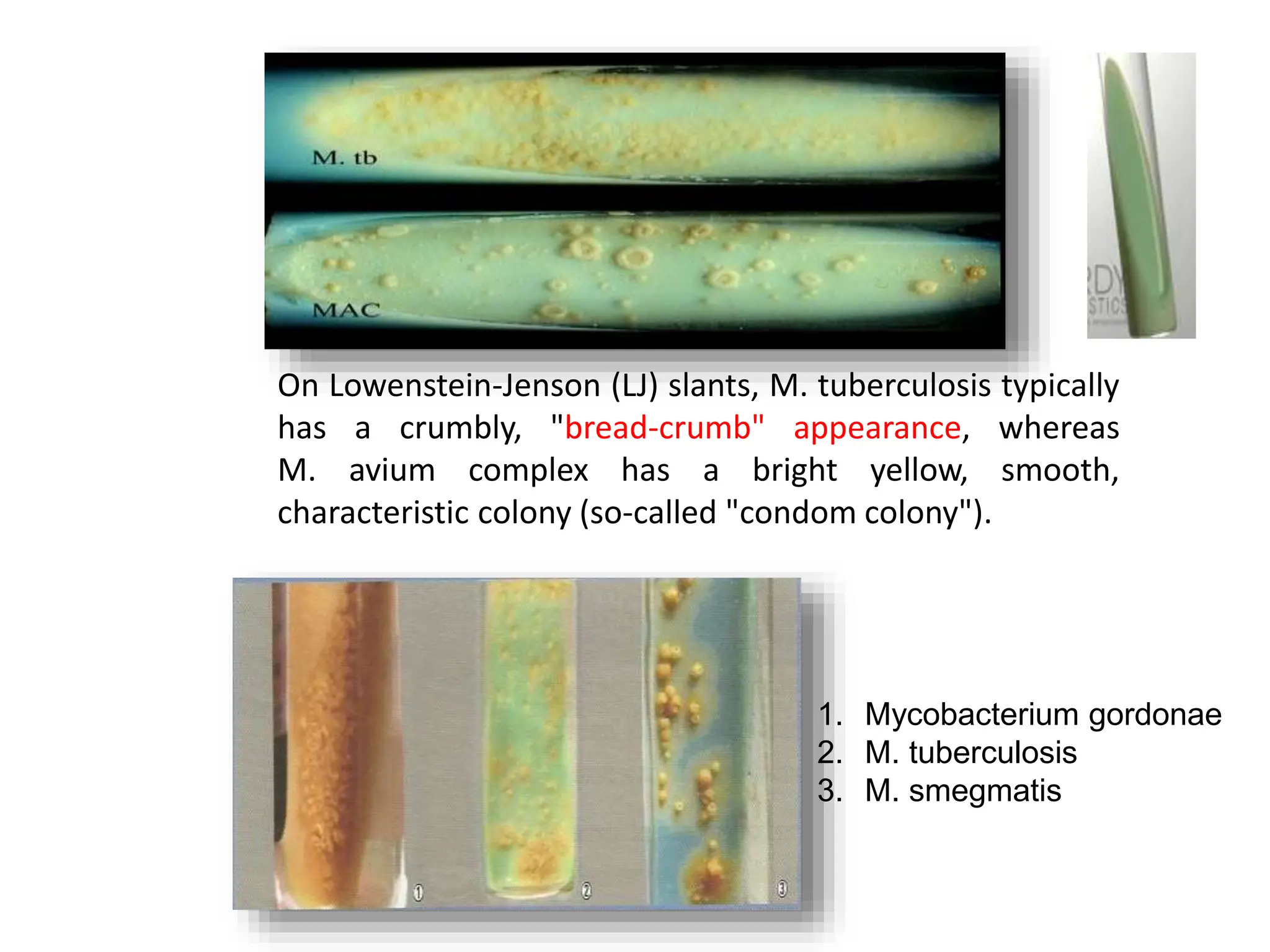 Mycobacterium.ppt bacterial diseases. Tb | PPT