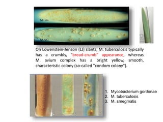 Mycobacterium.ppt bacterial diseases. Tb | PPT | Infectious Diseases ...