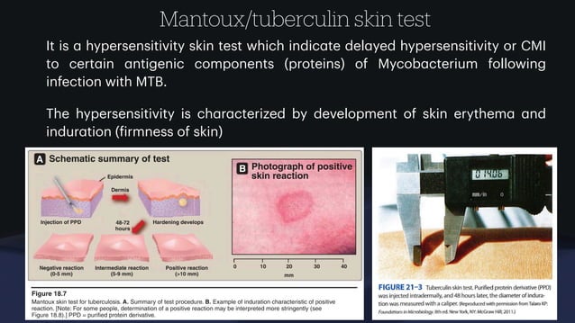 Lecture on Mycobacterium_Tuberculosis (SBMC).pdf