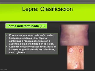 Mycobacterium leprae | PPTX