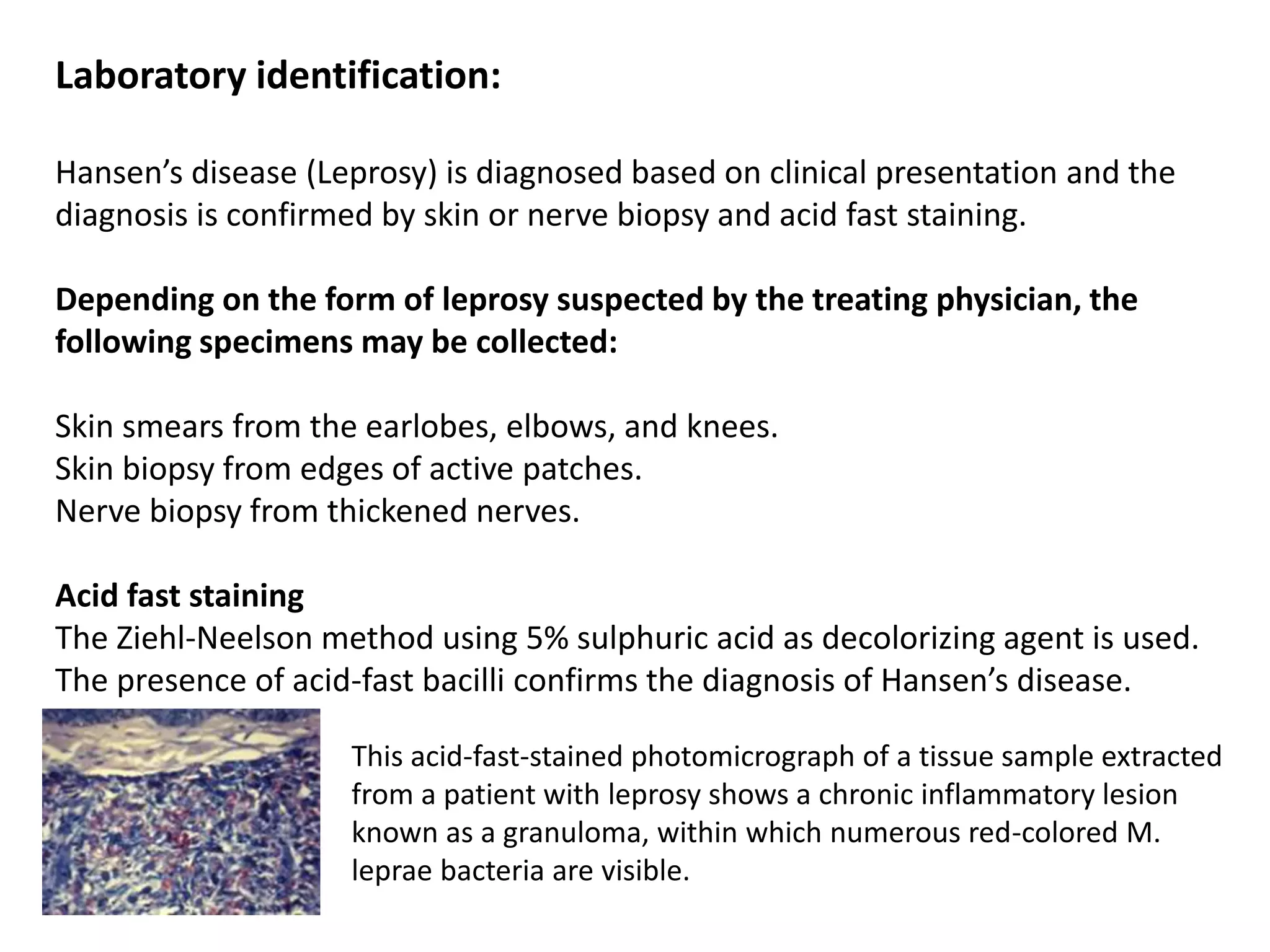 Mycobacterium leprae.ppsx