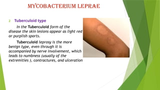 Medical bacteriology,Mycobacterium leprae | PPT