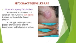 Medical bacteriology,Mycobacterium leprae | PPT