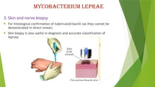 Medical bacteriology,Mycobacterium leprae | PPT