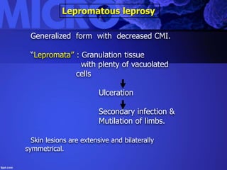 Mycobacterium leprae by aslam matania | PPTX