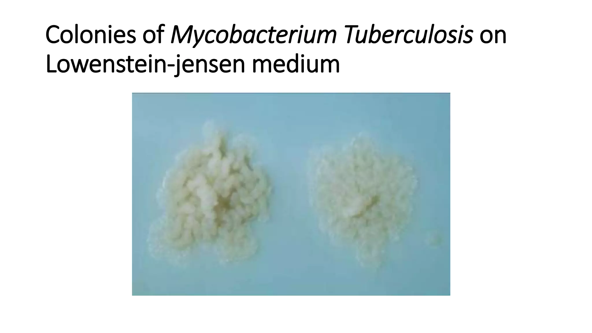 Mycobacterium Spp..pptx