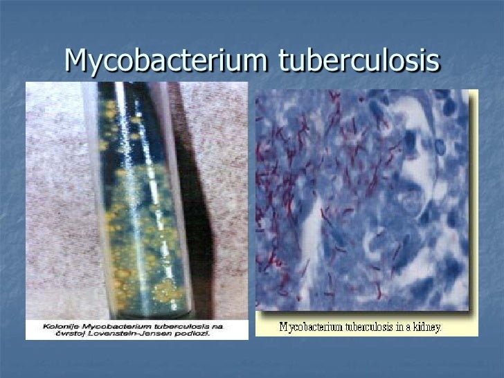 Mycobacterium Tuberculosis