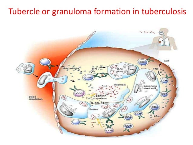 Mycobacterium tuberculosis