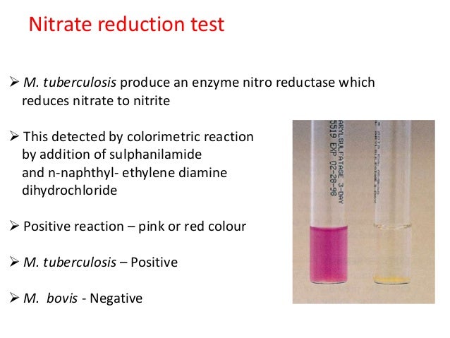 Mycobacterium tuberculosis