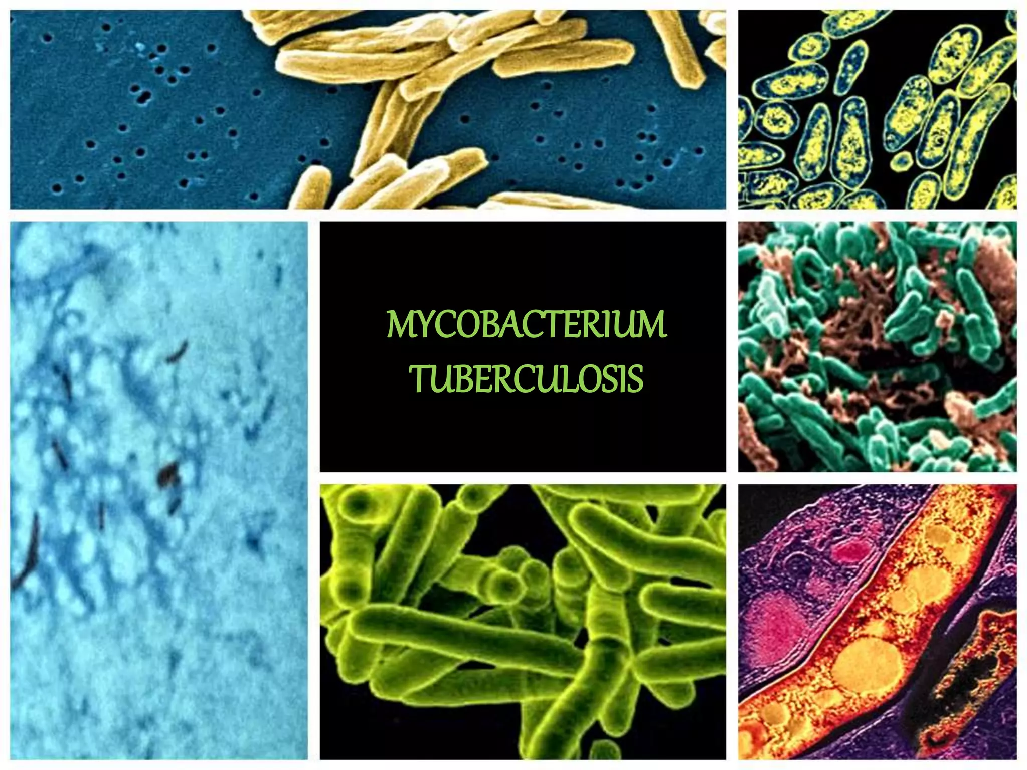 Mycobacterium tuberculosis(Microbiology) | PPTX