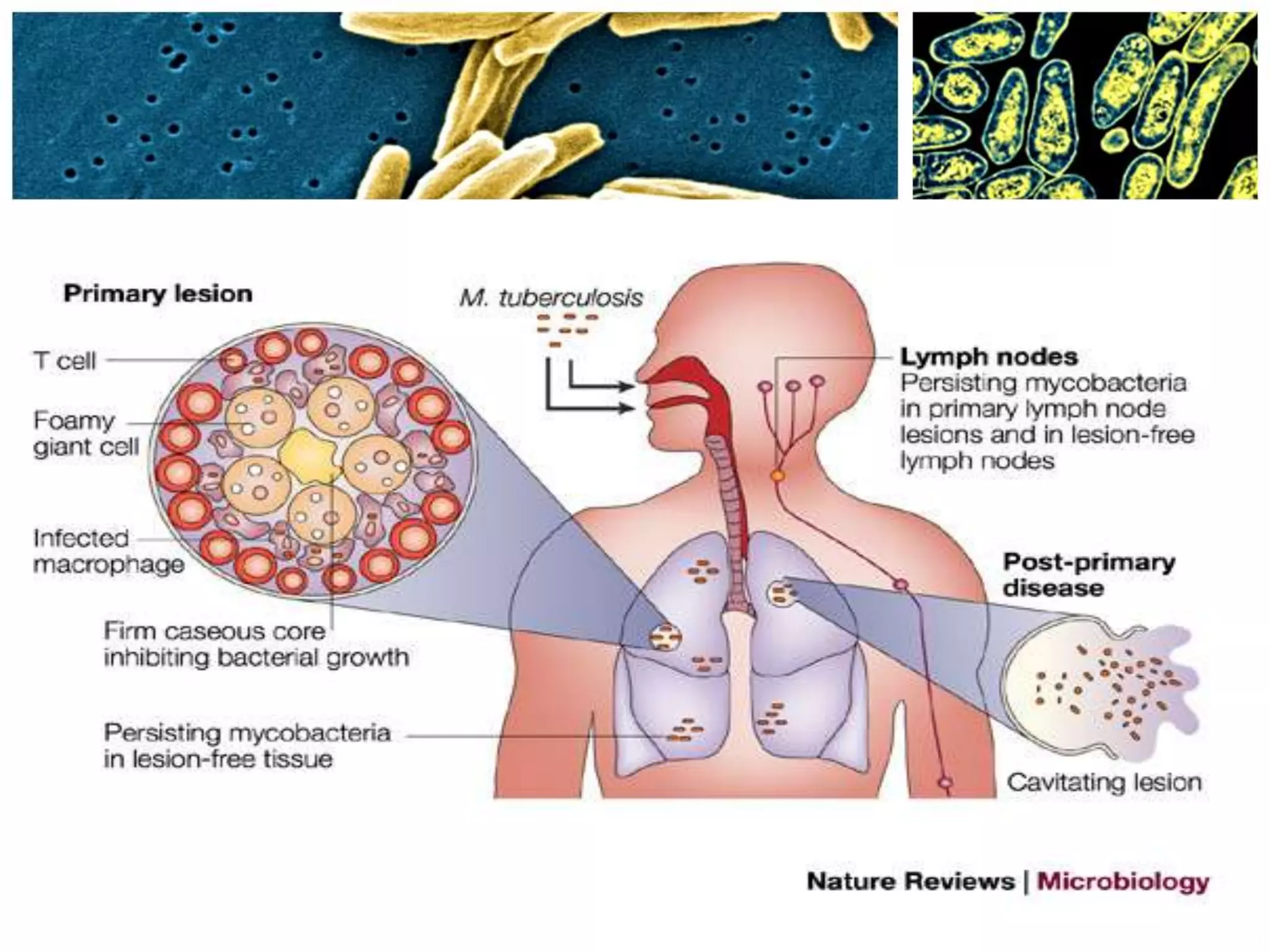 Mycobacterium tuberculosis(Microbiology) | PPTX