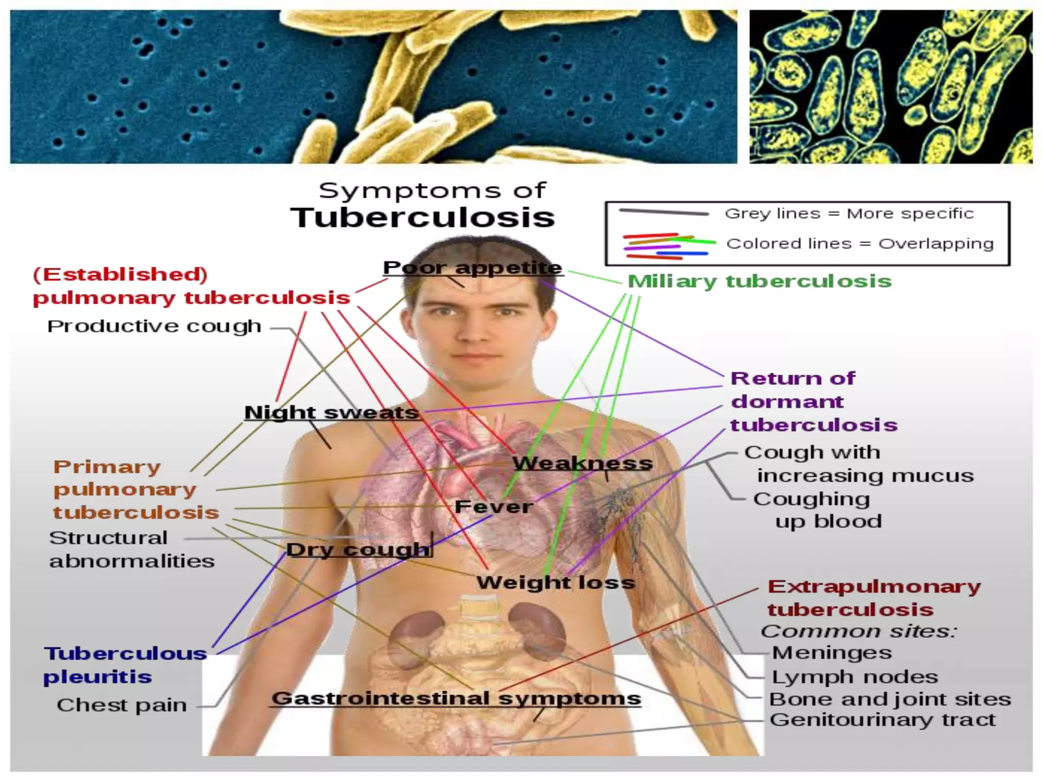 Mycobacterium tuberculosis(Microbiology) | PPTX