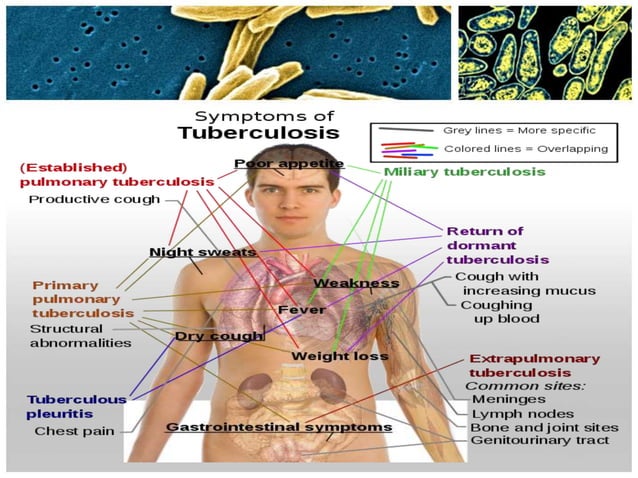 Mycobacterium tuberculosis(Microbiology) | PPTX | Infectious Diseases ...