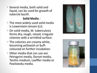 Mycobacterium Tuberculosis Culture