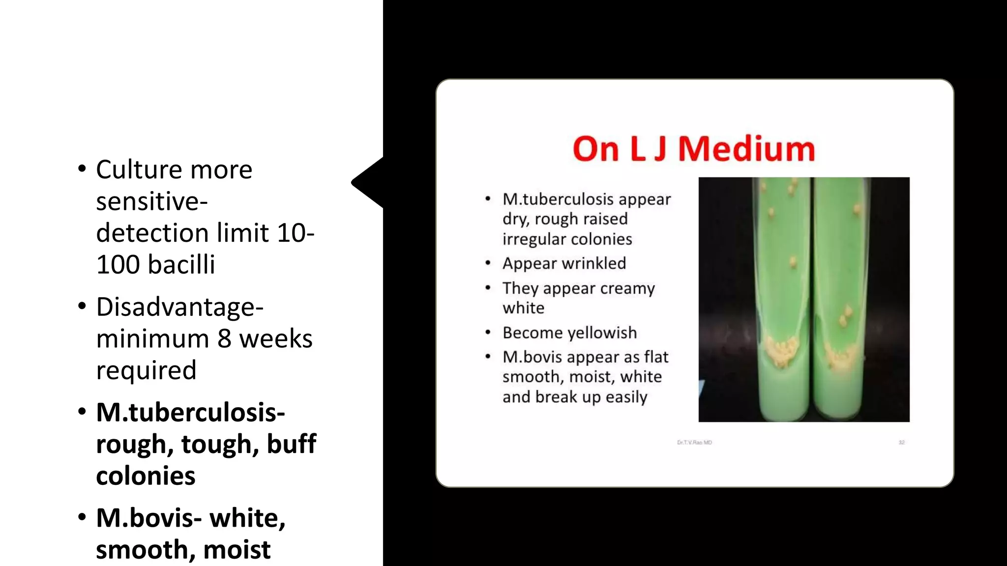 Mycobacterium tuberculosis | PPTX