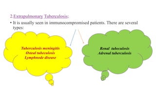 Mycobacterium tuberculosis-TB | PPTX