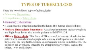 Mycobacterium tuberculosis-TB | PPT