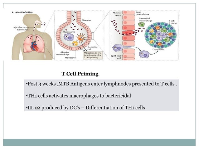 MYCOBACTERIUM Tuberculosis immunopathogenesis | PPTX | Science