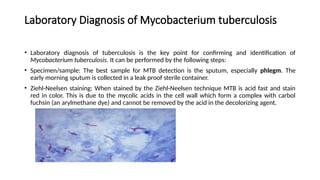 Mycobacterium tuberculosis. Informations | PPTX