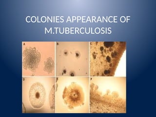 MYCOBACTERIUM TUBERCULOSIS overview slide share | PPT