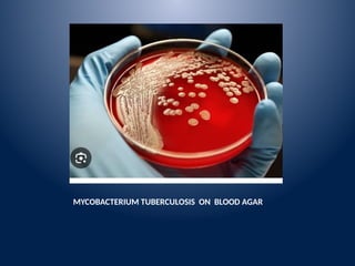 MYCOBACTERIUM TUBERCULOSIS overview slide share | PPTX