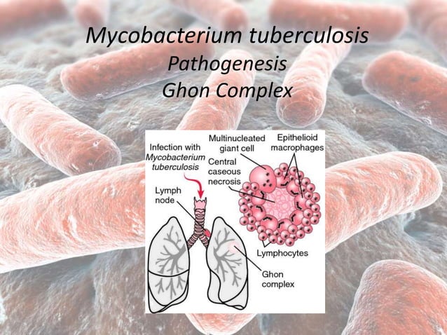 Mycobacterium tuberculosis and atypical mycobacteria | PPTX