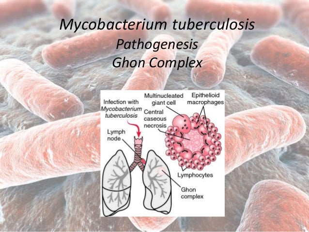 Mycobacterium tuberculosis and atypical mycobacteria