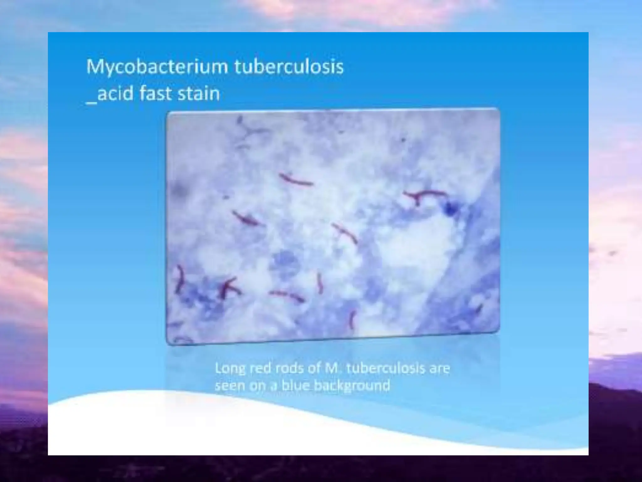 Mycobacterium Tuberculosis MBBS 3r. pptx | PPTX