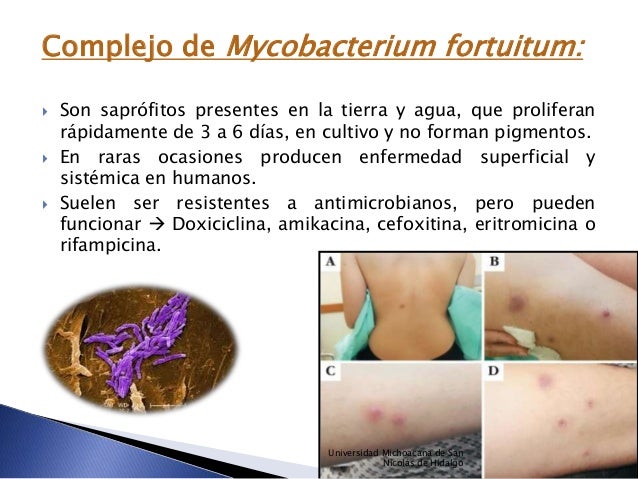 Mycobacterium Fortuitum