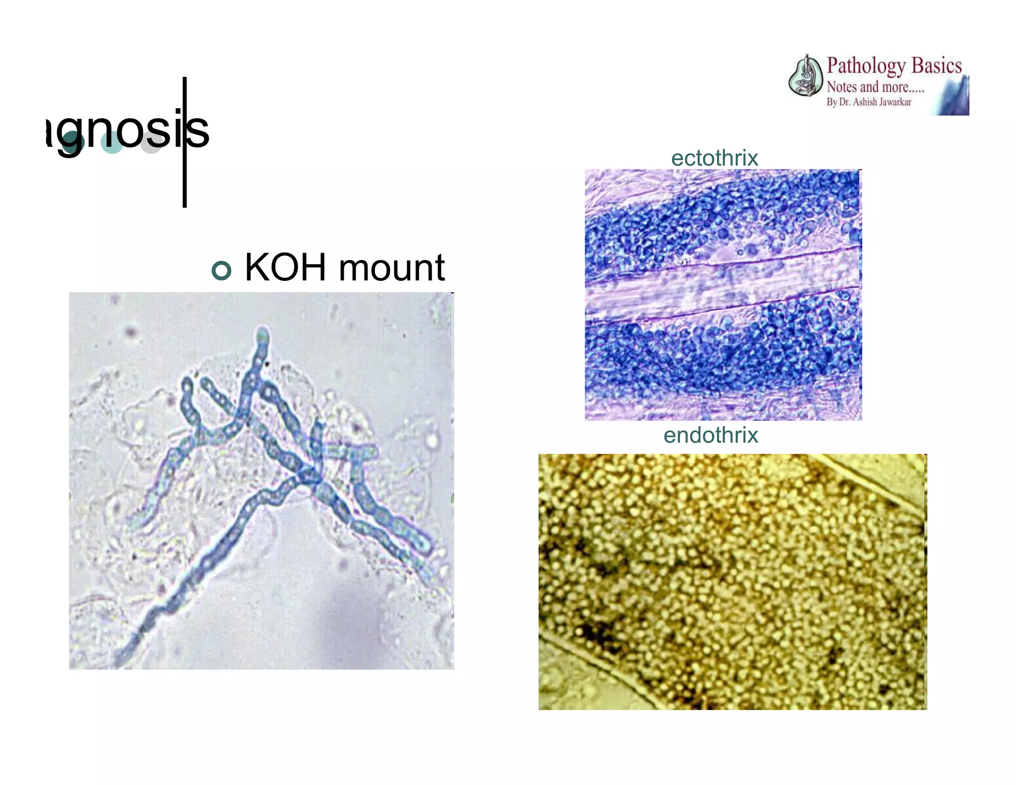 Mycology - all about fungi | PDF
